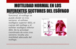 Acalasia del esofago | PPTX