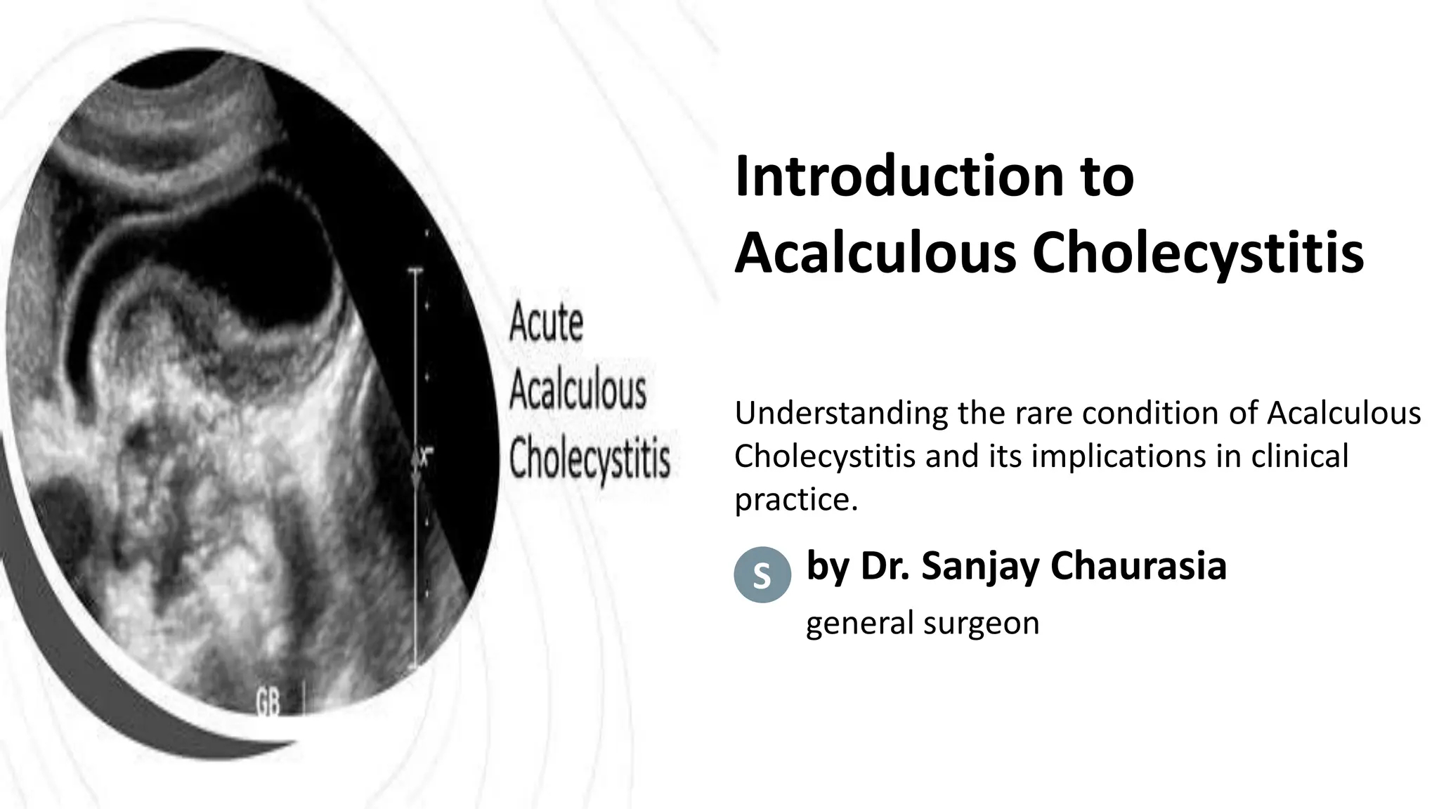 What to know about Acalculous cholecystitis? | PPTX