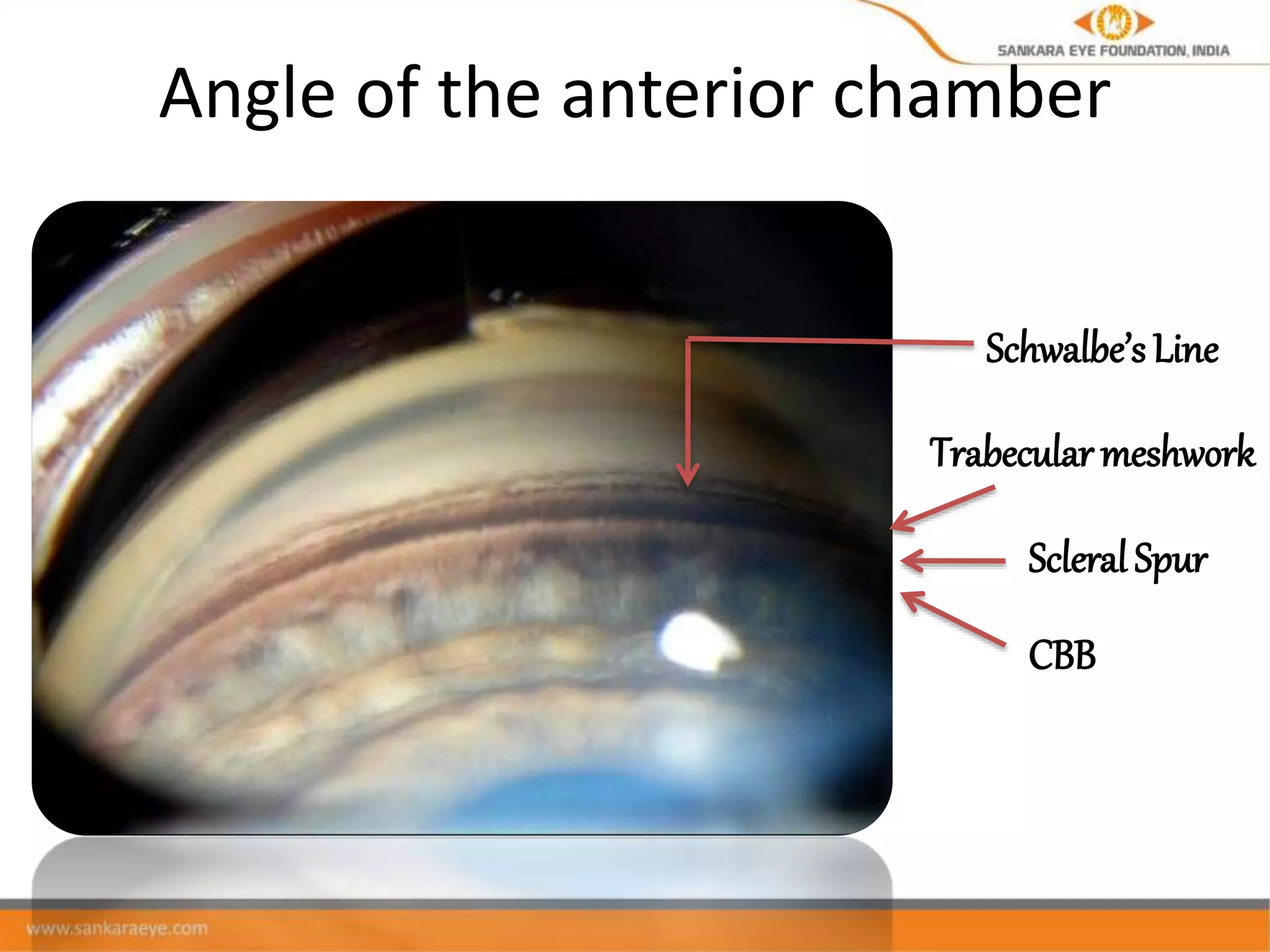 Anatomy of the anterior chamber and angle | PPTX