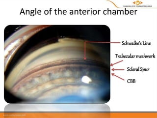 Slt Angle For Anatomy