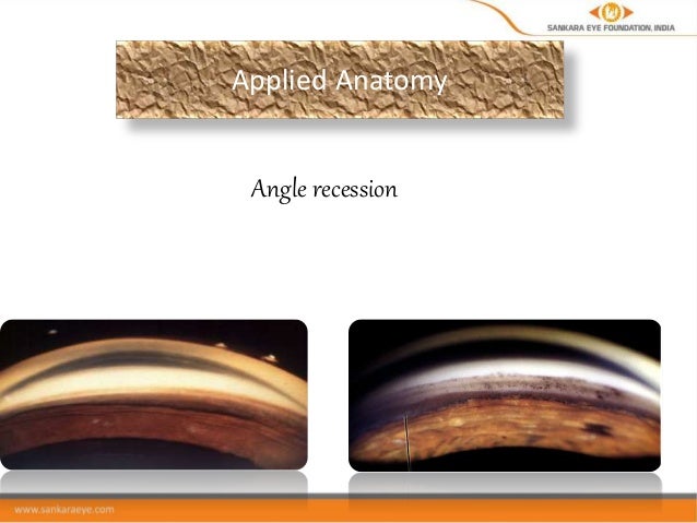 Anatomy of the anterior chamber and angle