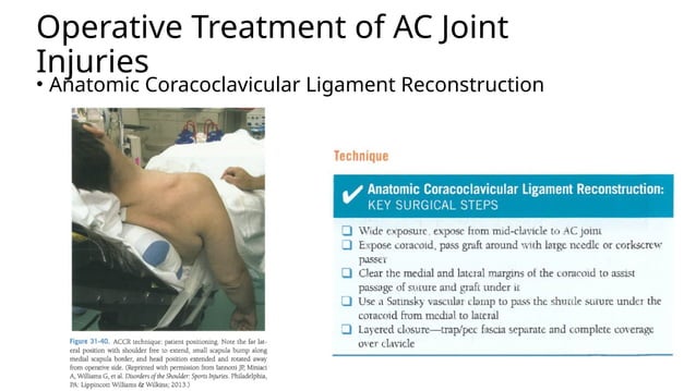 Acromioclavicular and sternoclavicular joint injuries.pptx
