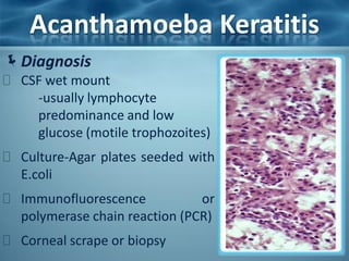 Acanthamoeba | PDF