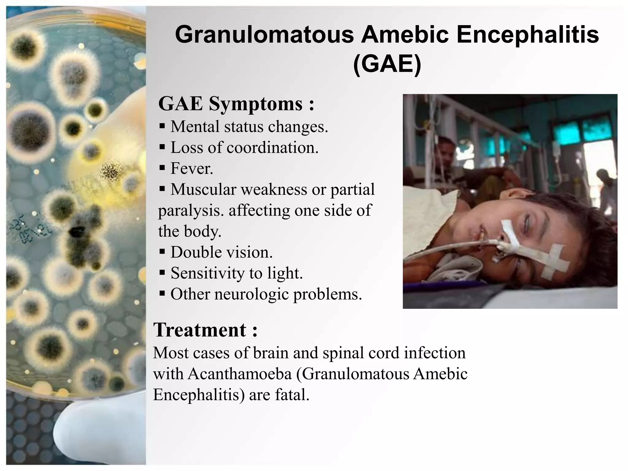 Acanthamoeba | PPTX