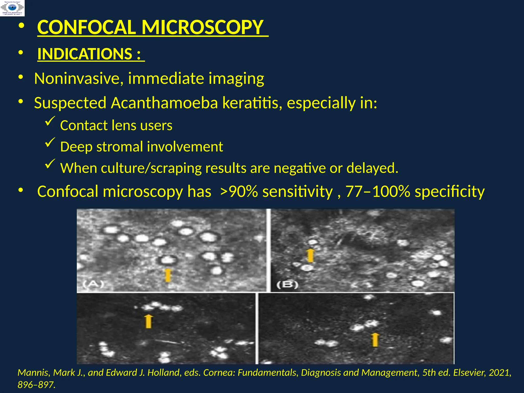 ACANTHAMOEBA KERATITIS , ODAK TRIAL , CLINICAL FEATURES , MANAGEMENT | PPTX