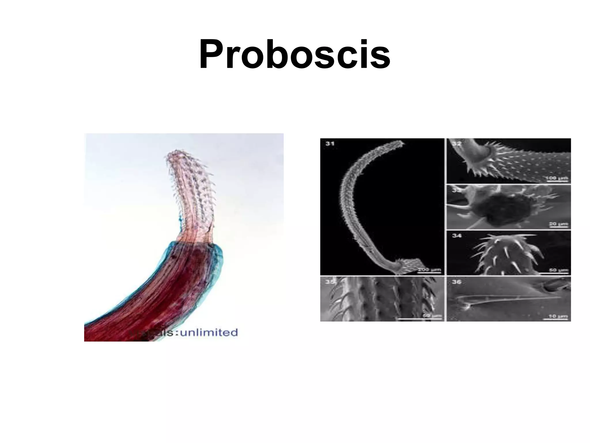 Acanthocephalan parasitic disease in fishes | PPT