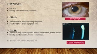 ANTERIOR CHAMBER & AQUEOUS HUMOR DYNAMICS.pptx