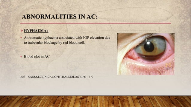 ANTERIOR CHAMBER & AQUEOUS HUMOR DYNAMICS.pptx