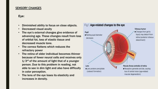 Nursing care of the elderly patients | PPTX | Eye and Vision Conditions ...