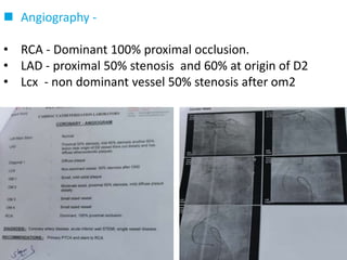 A case of 100% blocked Right coronary artery | PPTX