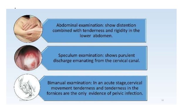 A case of acute Pelvic Inflammatory Disease (PID) | PPTX