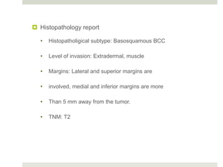 A case of BCC - Dr Hasan Khalaf | PPTX | Cancer | Diseases and Conditions