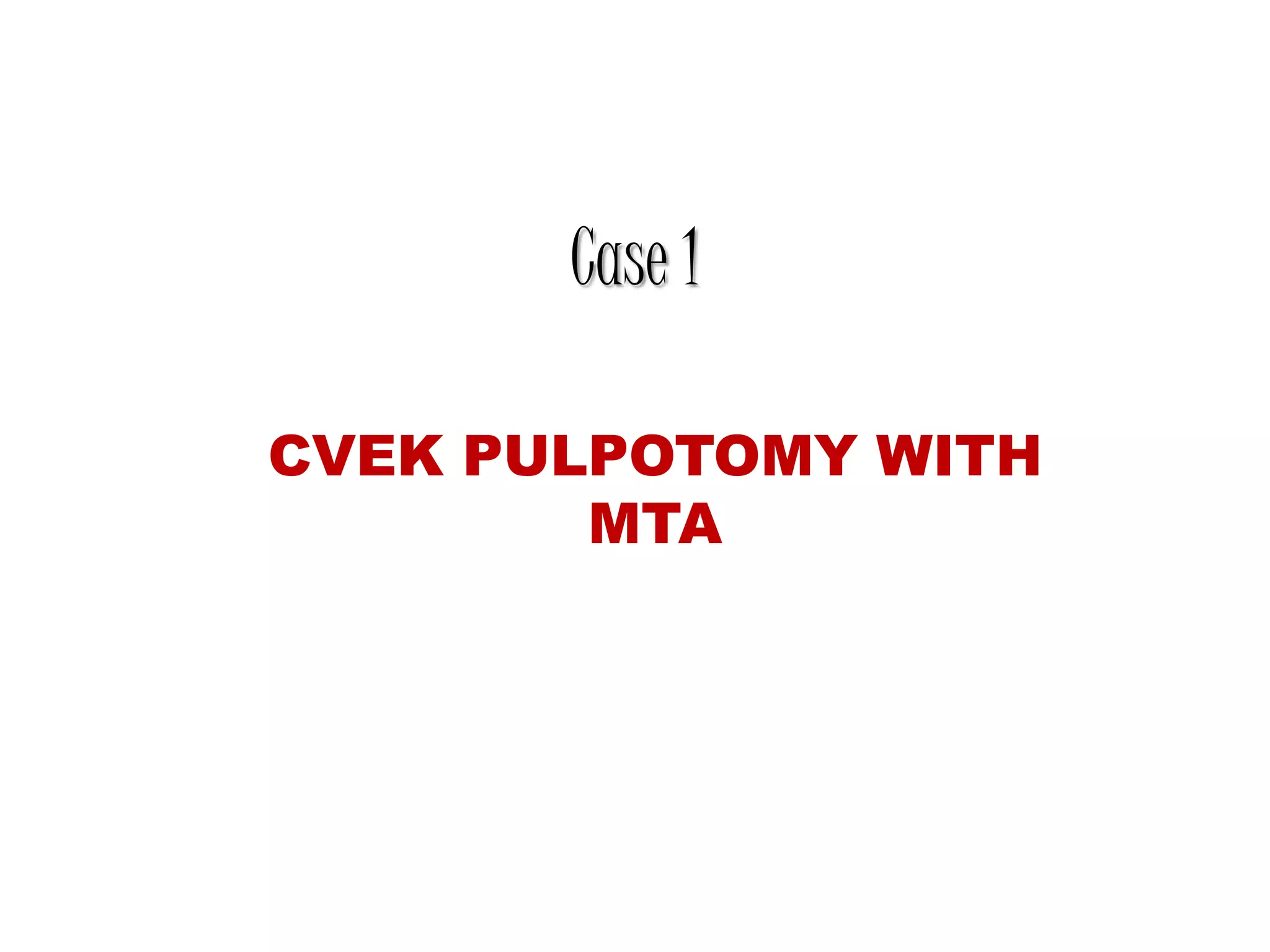 A case of cvek pulpotomy with mta | PPTX
