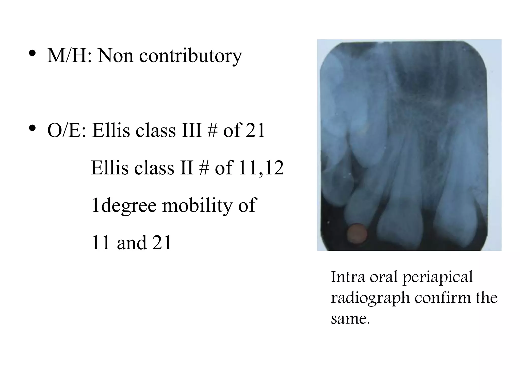 A case of cvek pulpotomy with mta | PPTX
