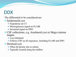 RUPTURED EPIDERMOID CYST | PPT