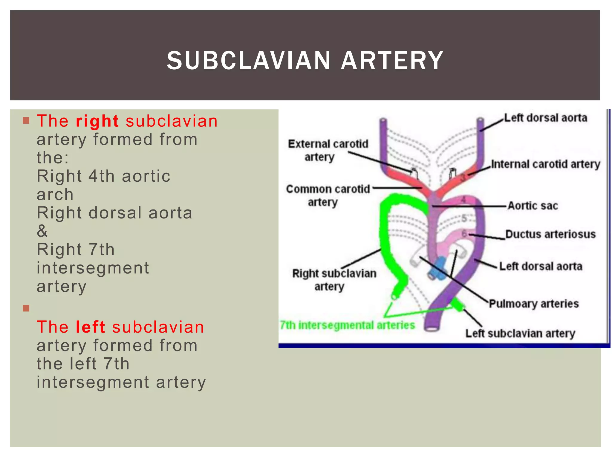 A case of dysphagia lusoria | PPTX