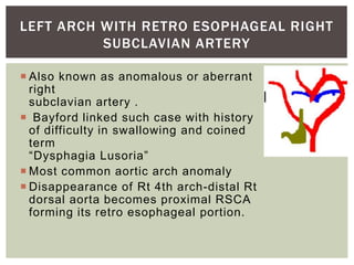 A case of dysphagia lusoria | PPTX