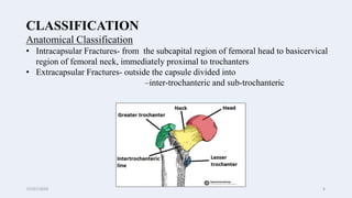 A case of fracture neck of femur | PPTX