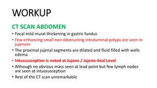 A case of intussusception with peutz jeghers syndrome.pptx