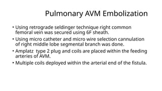 A case of pulmonary AV malformation.pptx