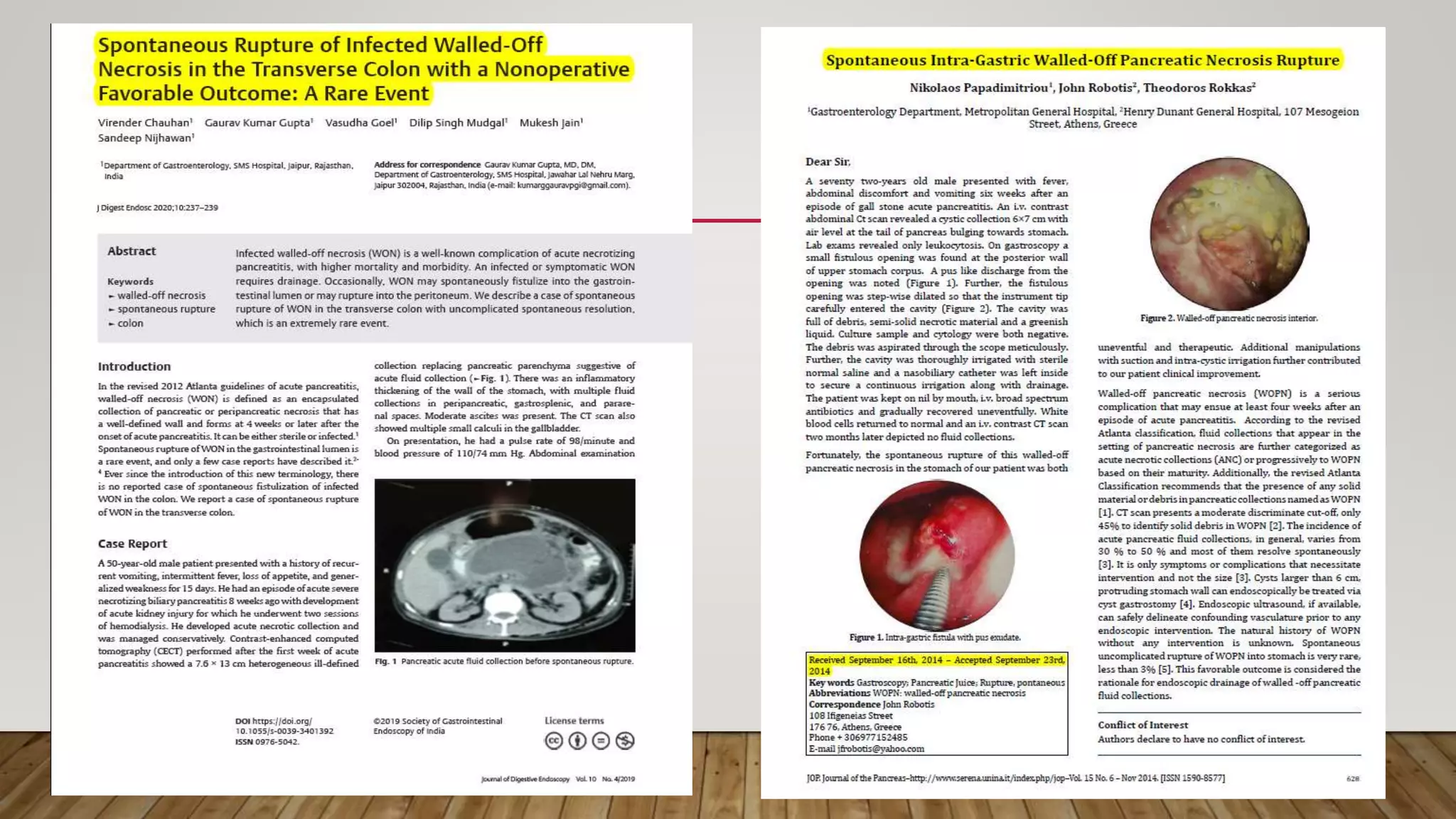 A case of recurrent acute pancreatitis with walled off necrosis ...