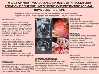 Right Paraduodenal Hernia with Gut Malrotation and Mesenteric Cyst ...