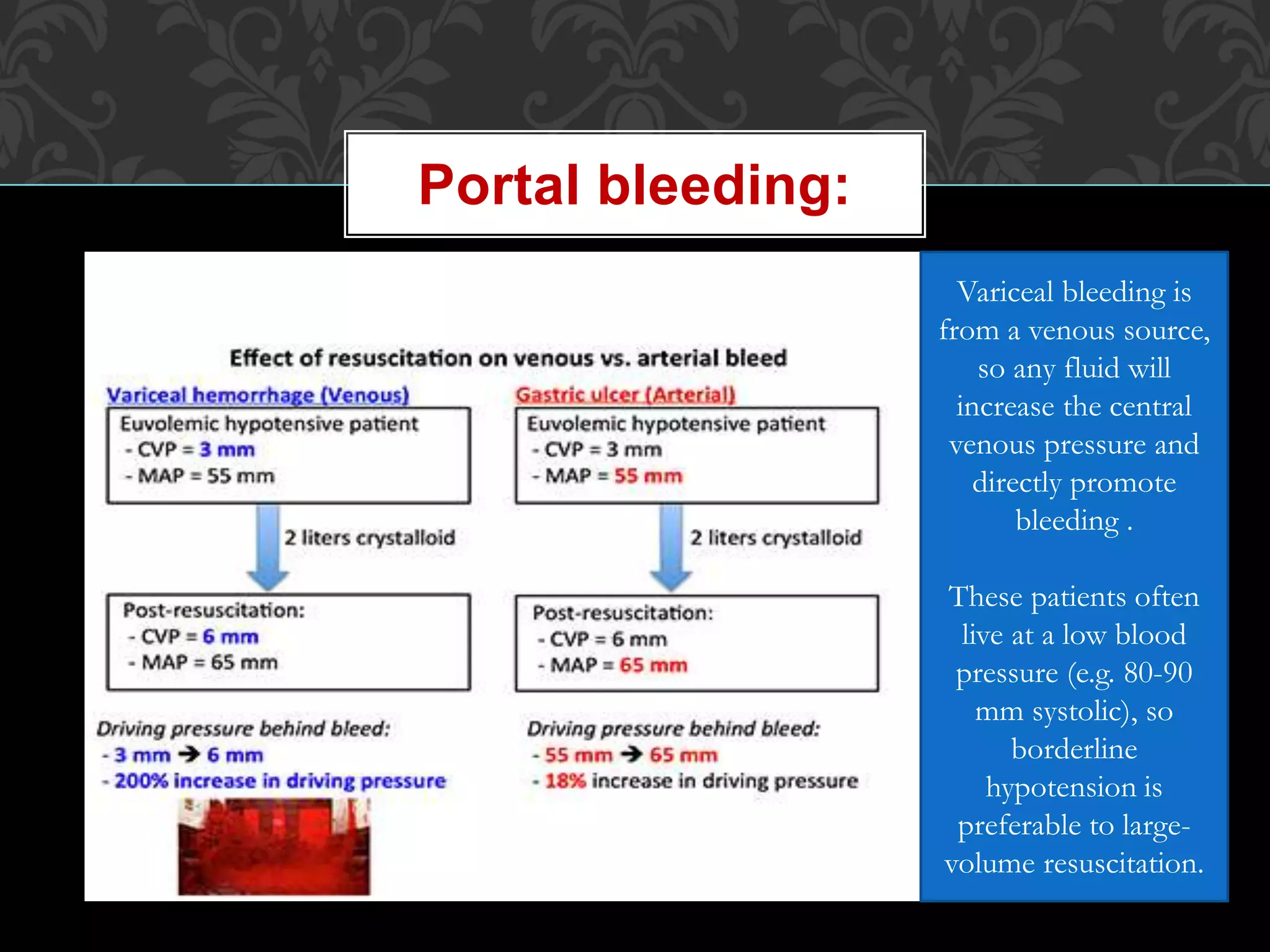 A case of Upper GI Bleeding.pptx