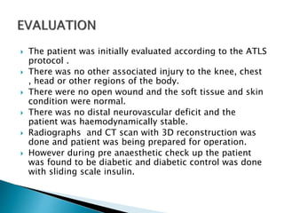 A case presentation of acetabular fracture treated through crif | PPTX