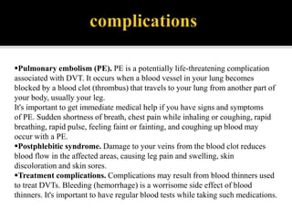 deep vein thrombosis | PPTX