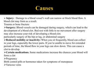 deep vein thrombosis | PPTX