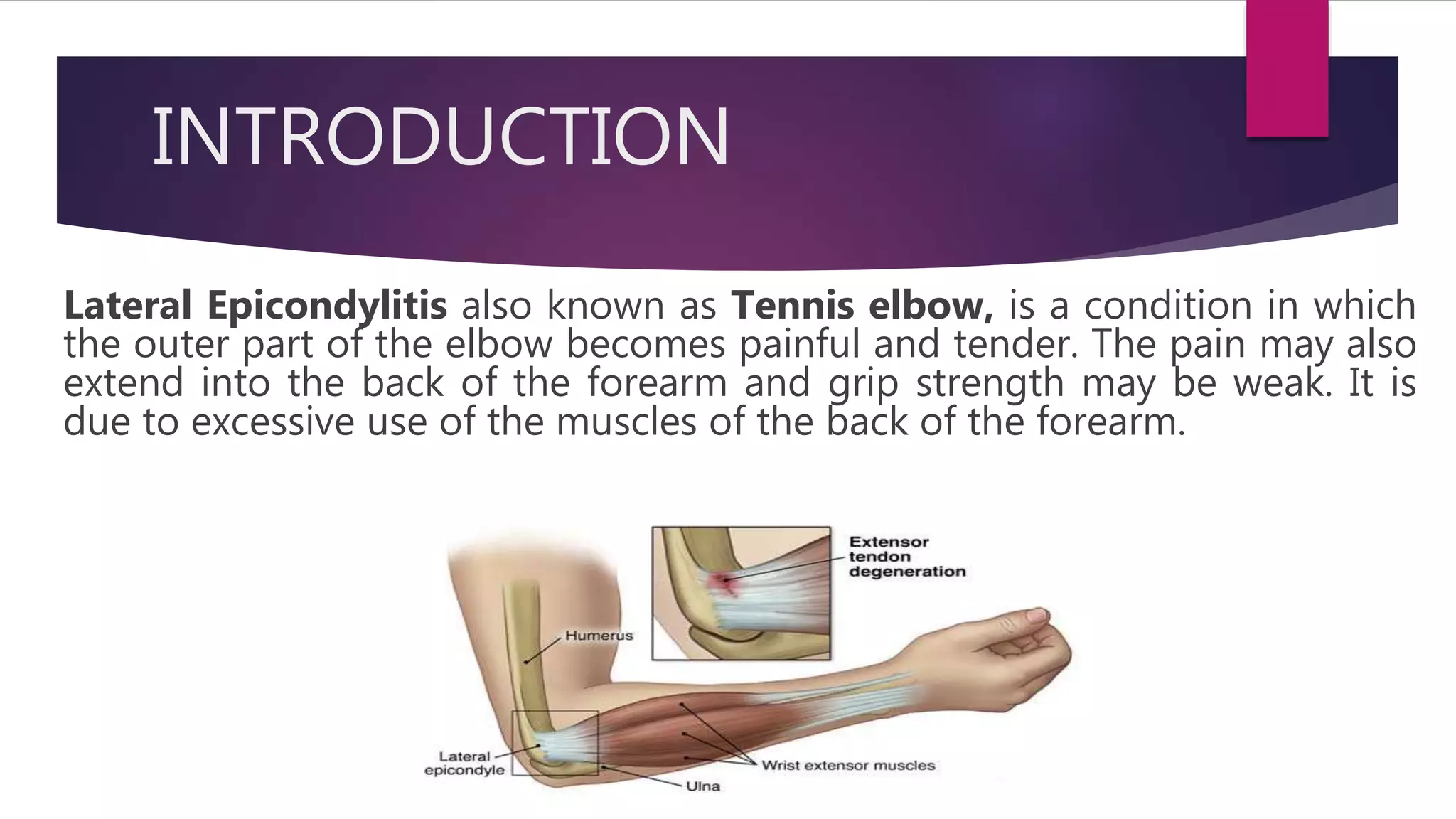 A case presentation on lateral epicondylitis by prasanjit shom | PPTX