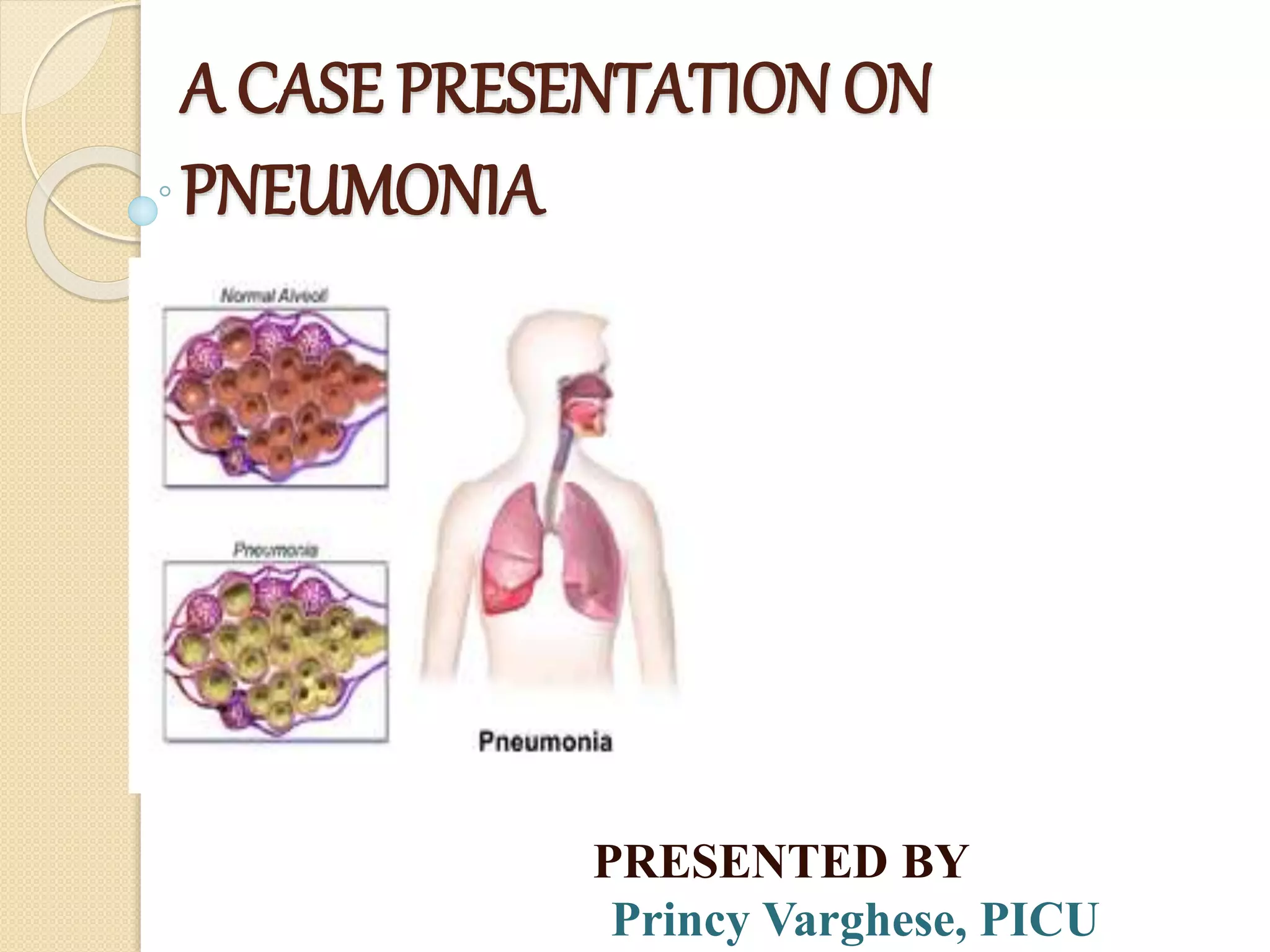 A case presentation on pneumonia | PPTX