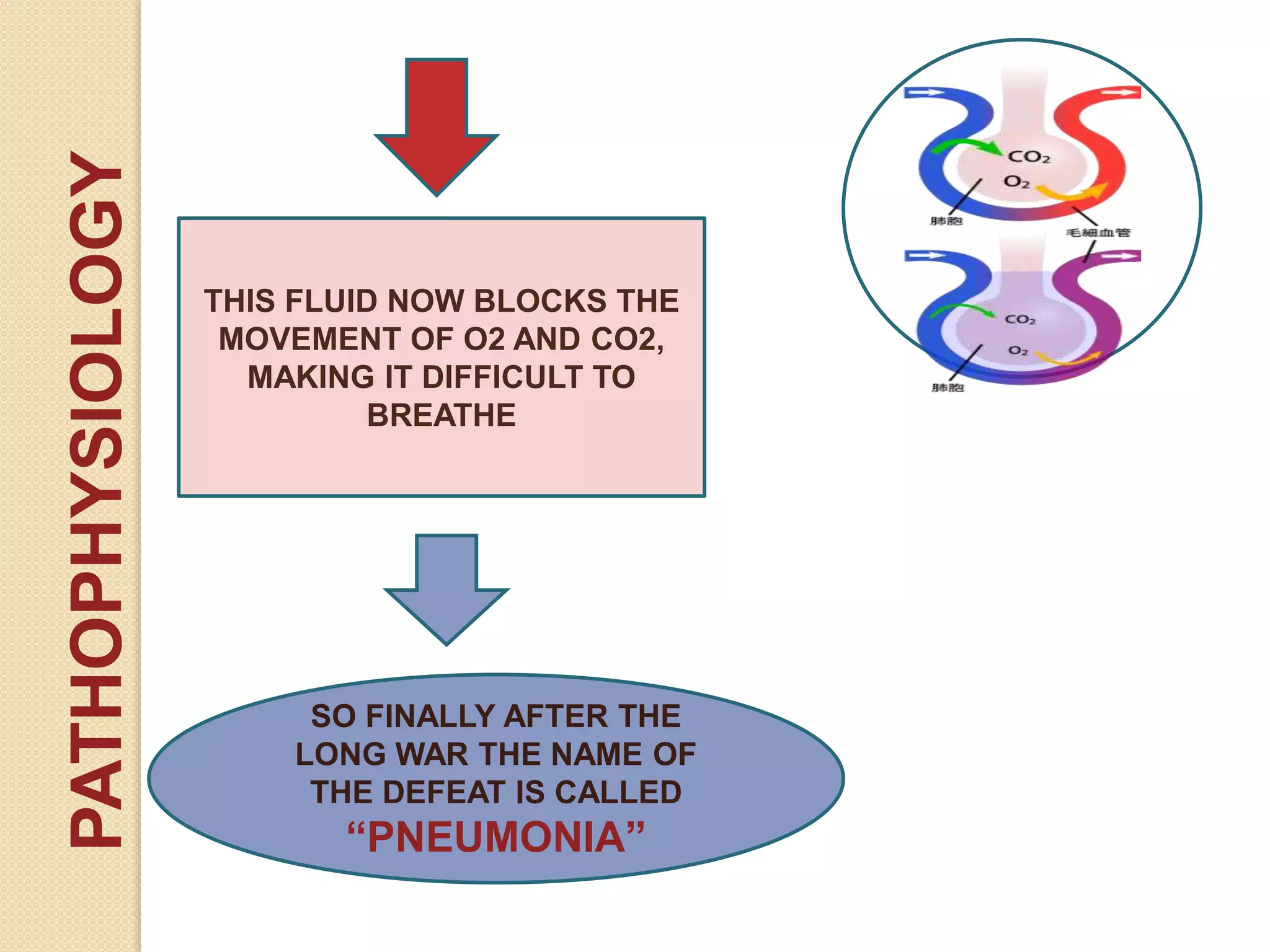 A case presentation on pneumonia | PPTX