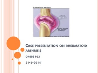 A case presentation on rheumatoid arthritis | PPTX