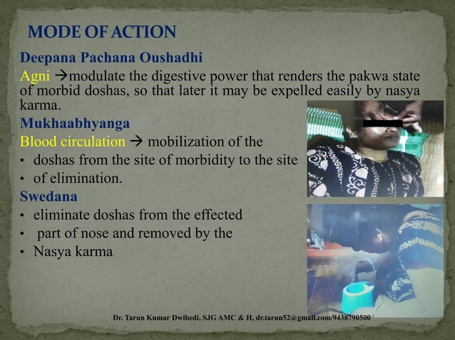 A case report -- Apeenasa/ Atrophic rhinitis-Shdabindu Taila Nasya ...