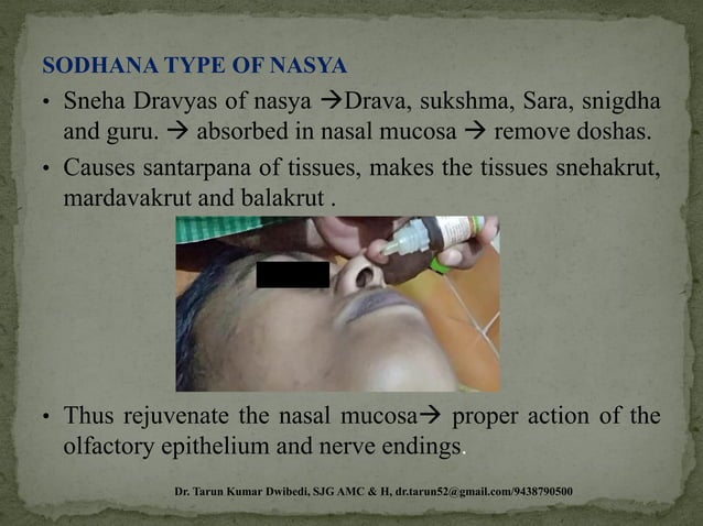 A case report -- Apeenasa/ Atrophic rhinitis-Shdabindu Taila Nasya ...