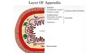 appendicitis | PPT