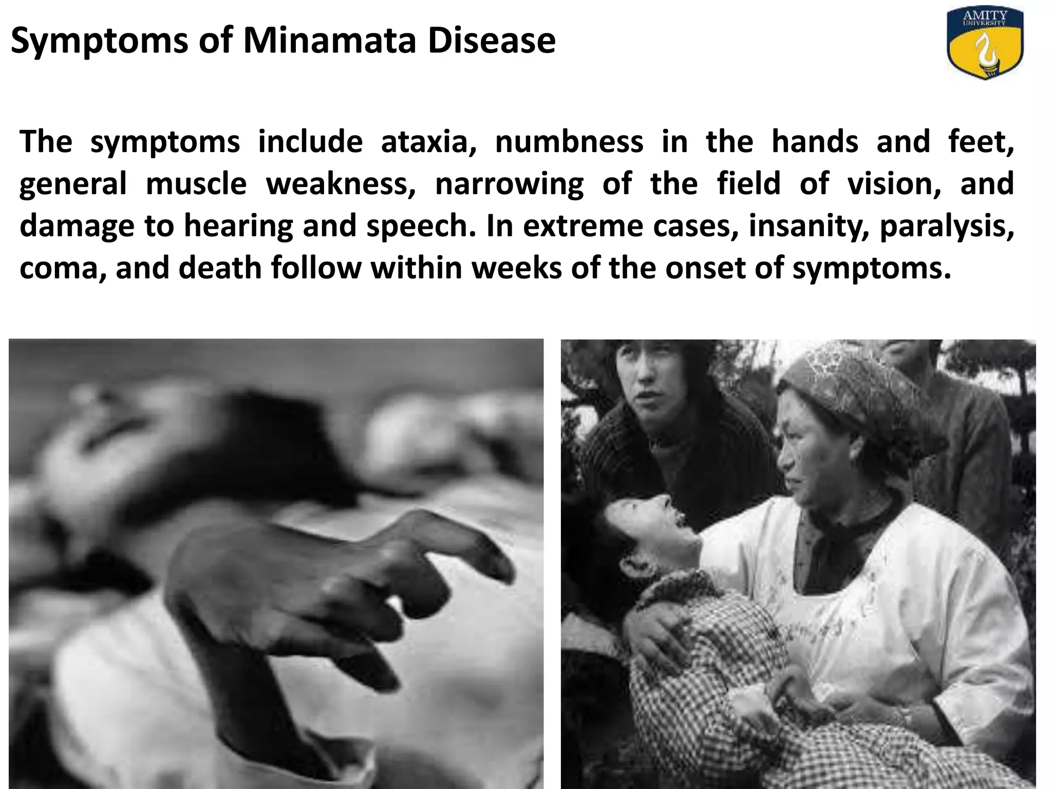 A case study on minamata disease-By Ritu Chauhan | PPTX