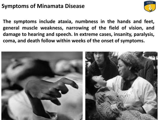 A case study on minamata disease-By Ritu Chauhan | PPTX | Diseases and ...
