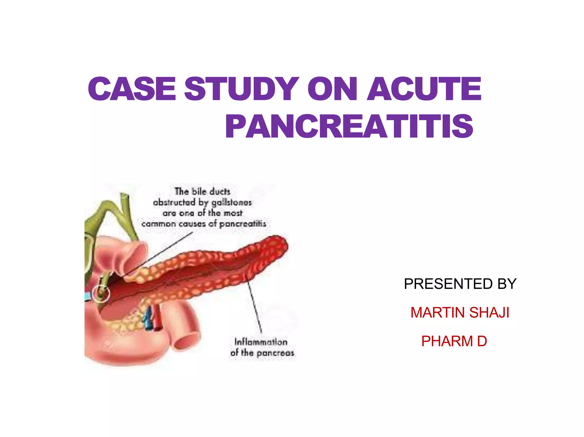 A case study on acute pancreatitis | PPTX