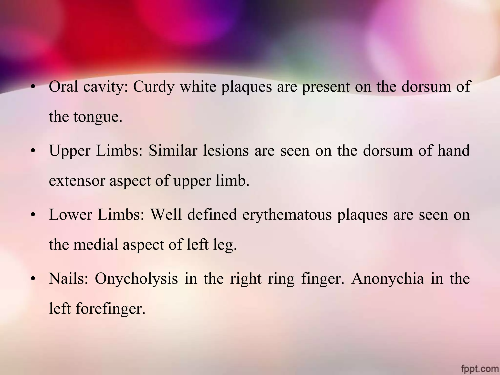 A case study on systemic lupus erythamatosus | PPTX