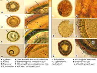 Acaulospora: Classification & Characteristic | PPTX