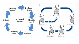 Active Cycle Of Breathing Technique