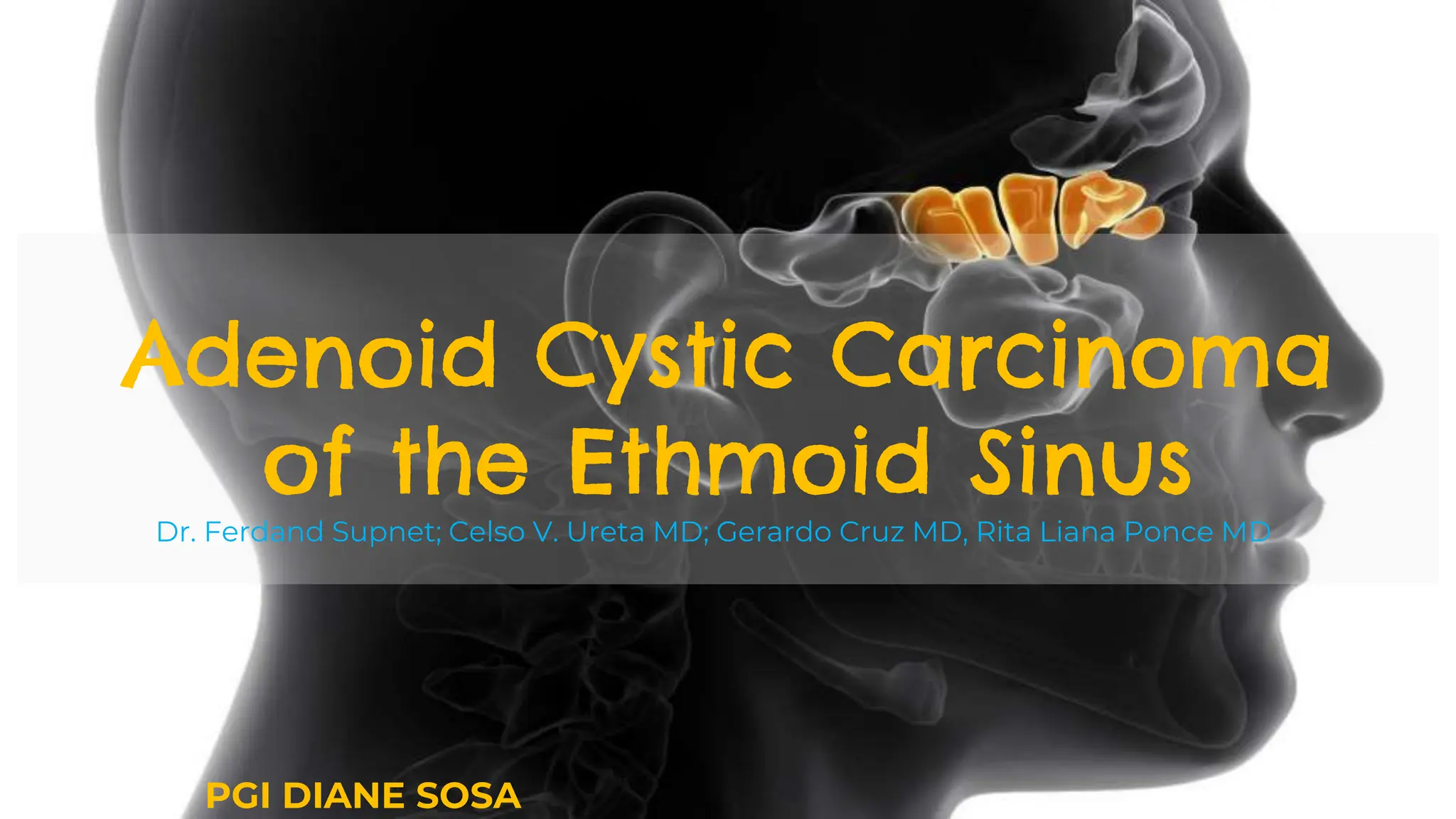 Adenoid Cystic Carcinoma of the Ethmoid Sinus | PPTX