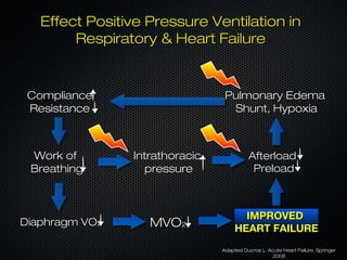 Respiratory Failure and Mechanical Ventilation Management, dr Dafsah | PPT