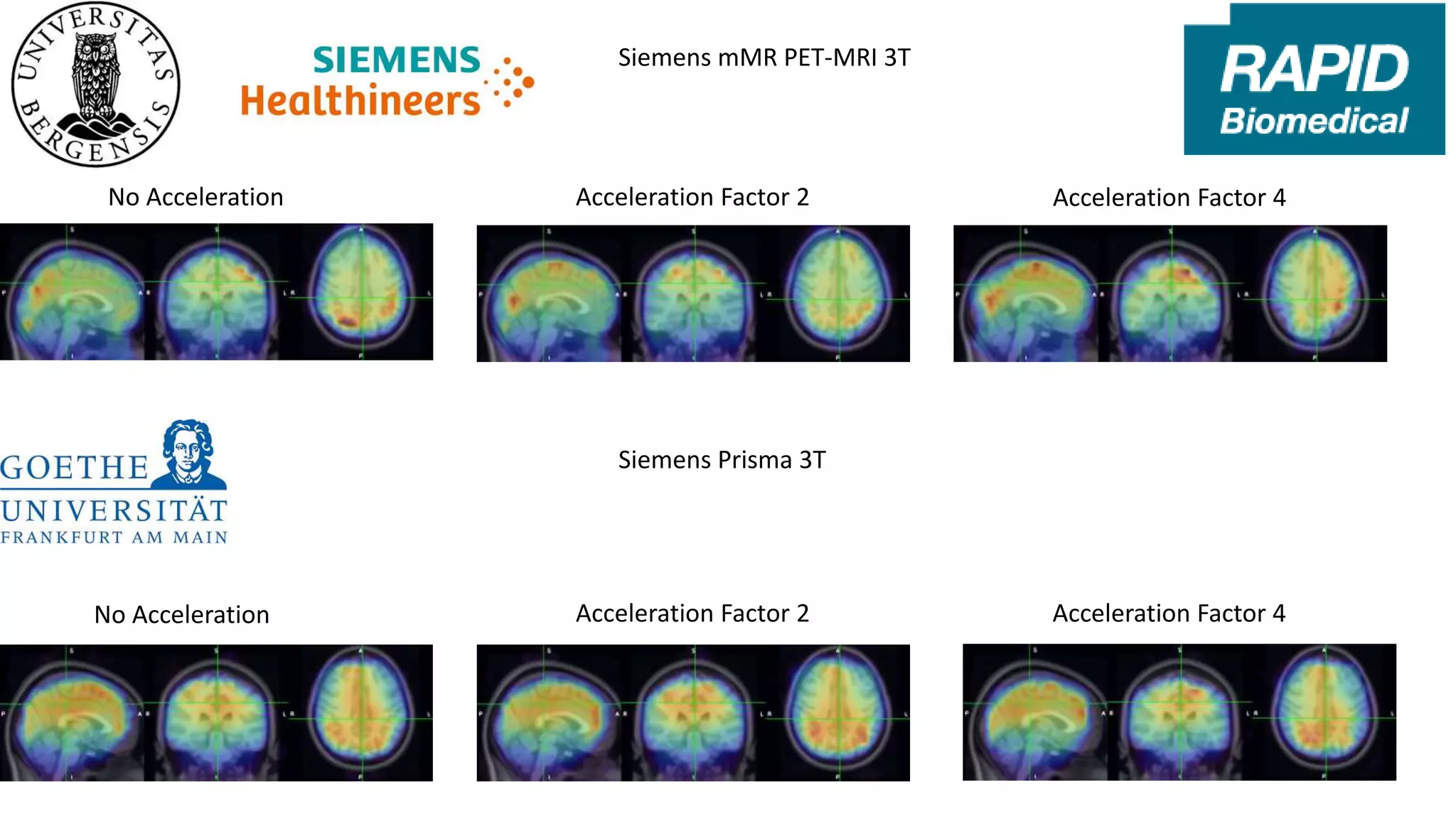 Ultra-Short Echo Time 31P 3D MRSI at 3T with Novel Rosette k-space ...