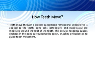 AcceleDent Aura in orthodontics treatment.pptx