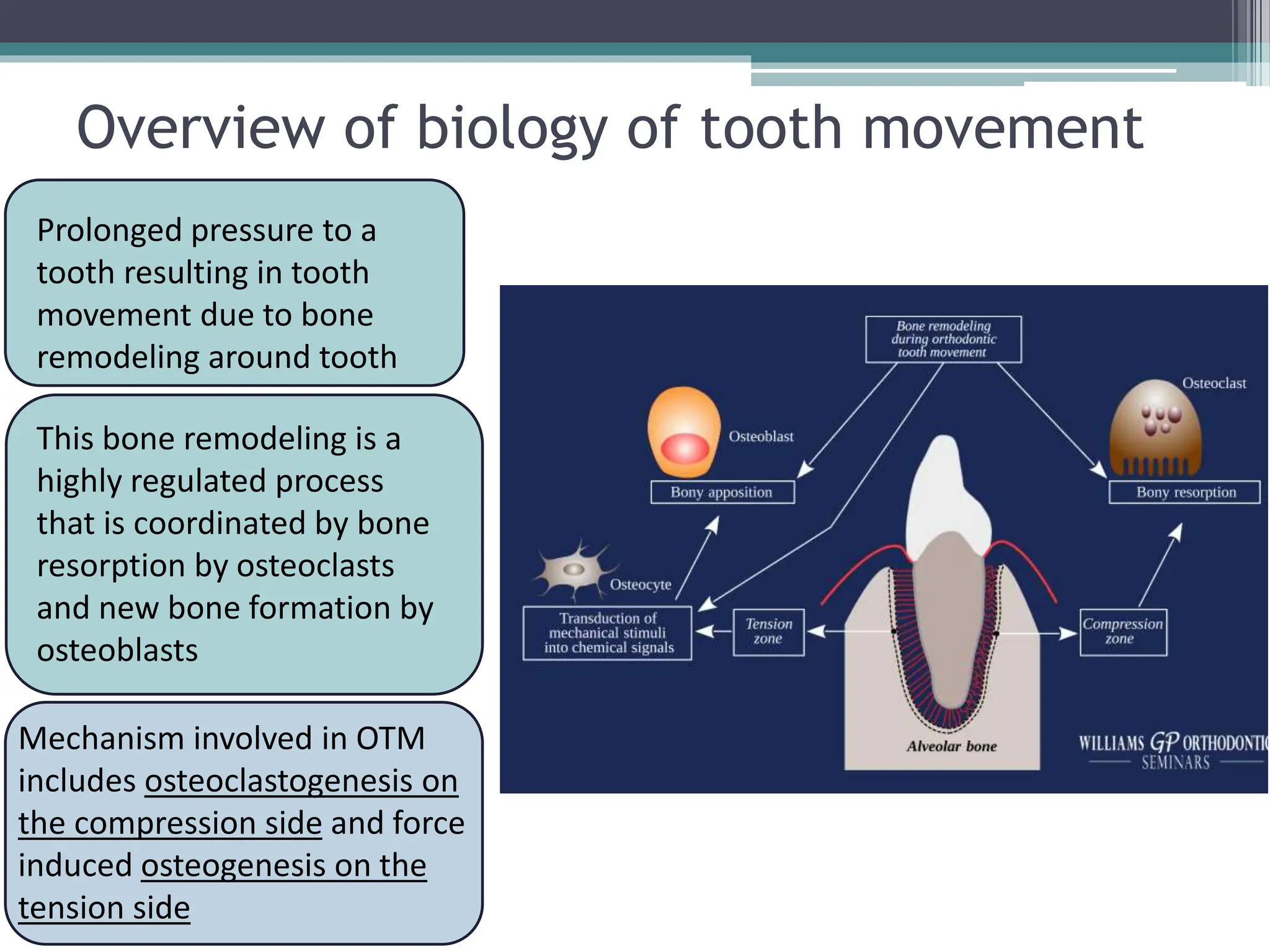 Accelerated Orthodontics, in light of current evidence | PPTX