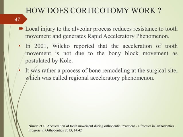 ACCELERATED ORTHODONTICS in orthodontic tooth movemnet | PDF | Bone and Joint Conditions ...