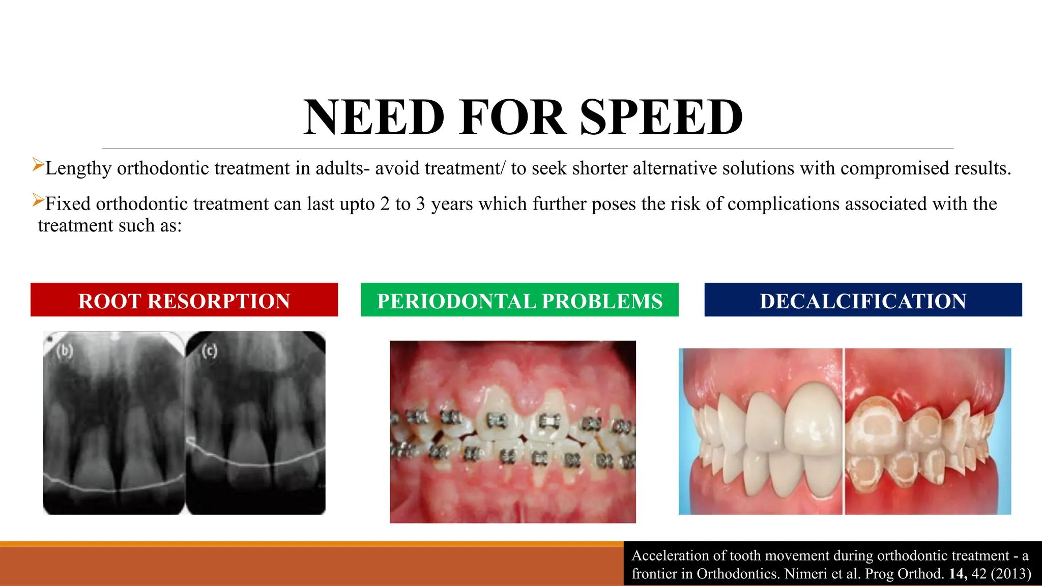 ACCELERATED ORTHODONTICS by dr ashwani singh.pptx